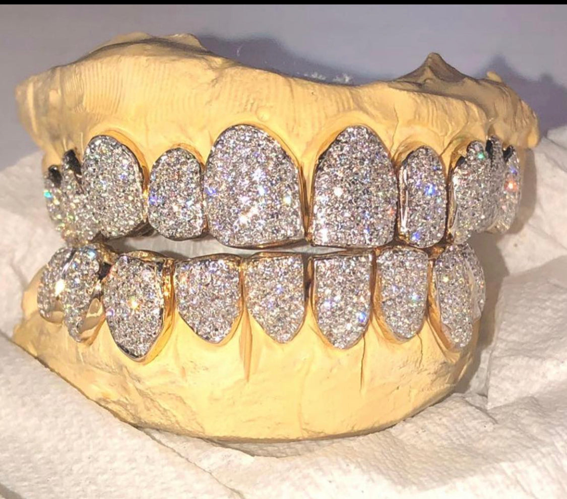 Diamond Grillz